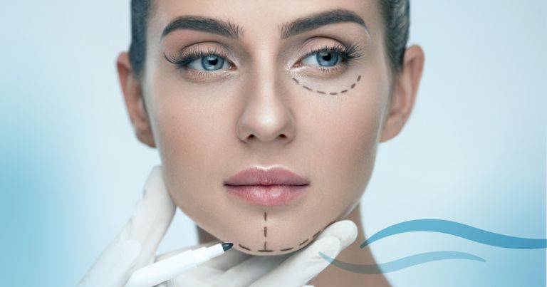 Liposucción submentoniana - Dra Lucia Hernández